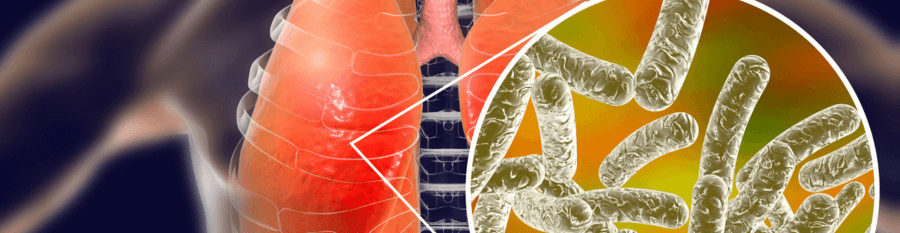 The Importance of Legionella Awareness Training