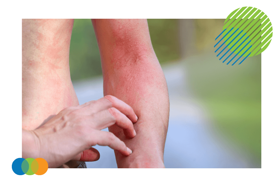 The Toxicity Symbol: What It Means for Your Safety